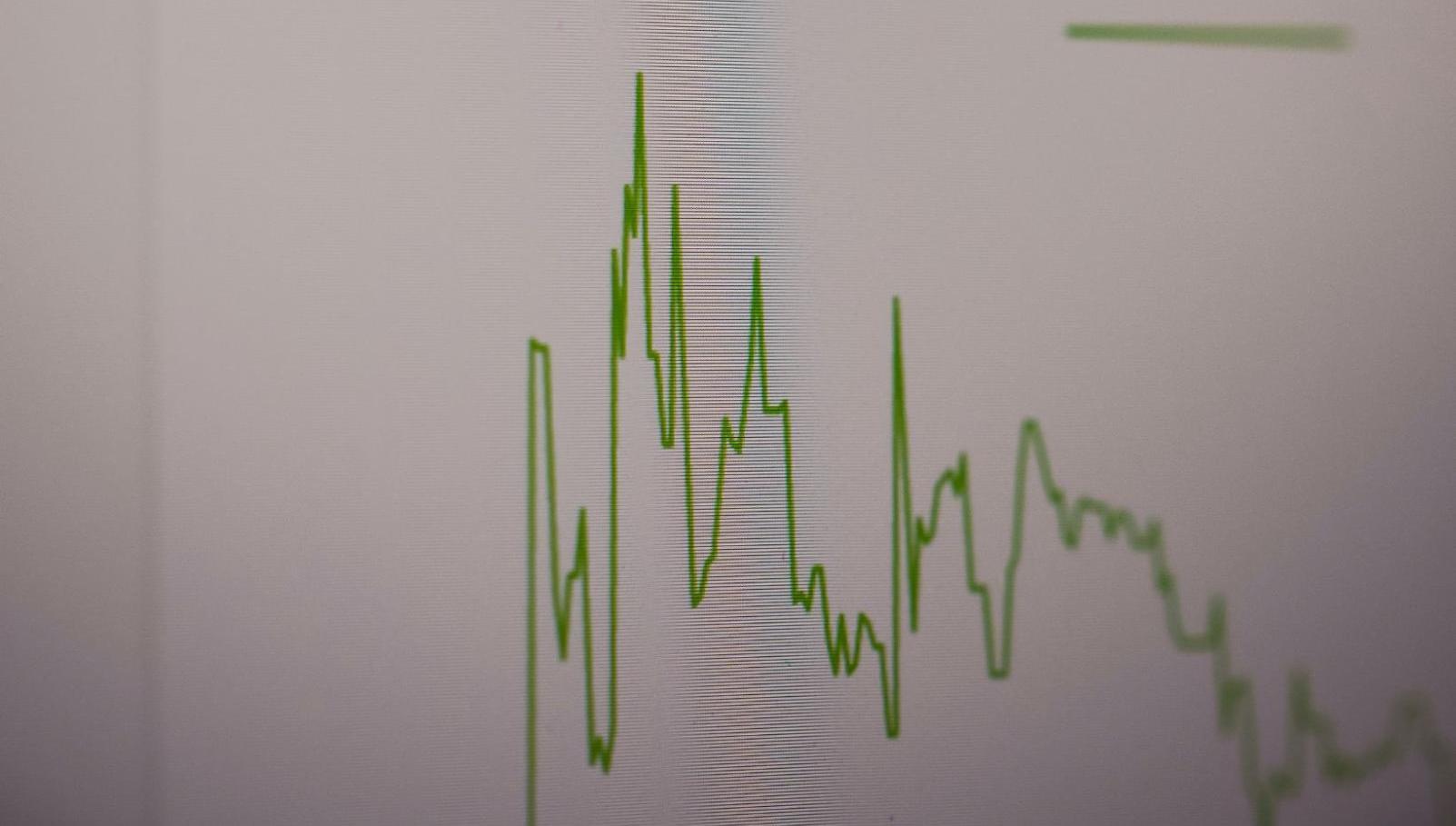 Asset and Liability Management (ALM) - Overview, Pros and Cons | Wall ...
